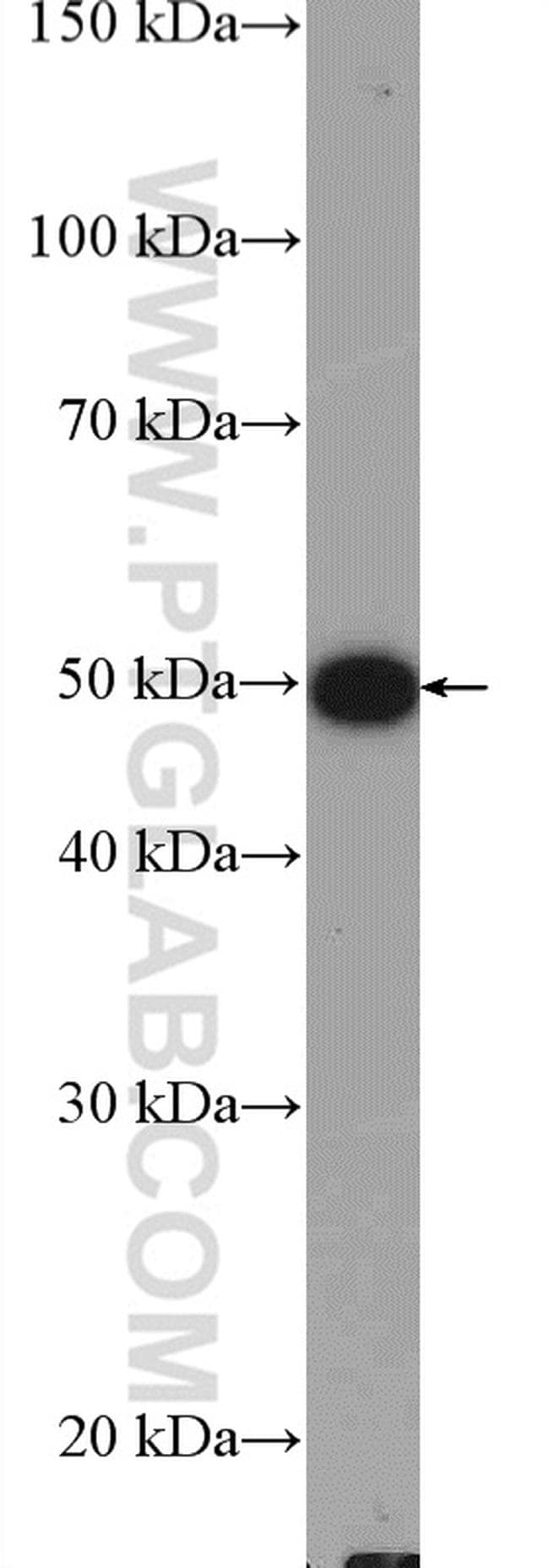 TRAIP Antibody (10332-1-AP)
