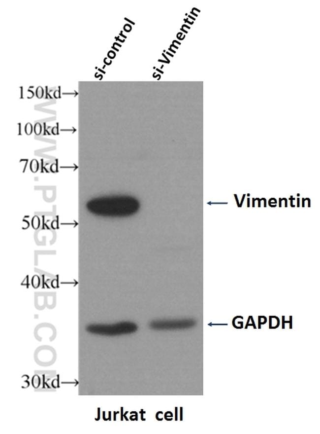 Vimentin Antibody (10366-1-AP)