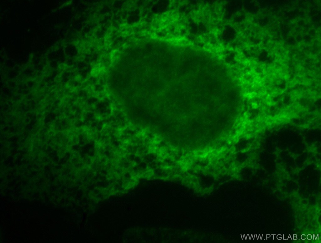 Calnexin Antibody (10427-2-AP)
