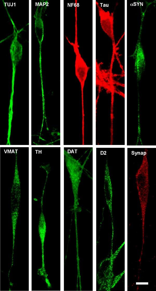 MAP2 Antibody (13-1500)