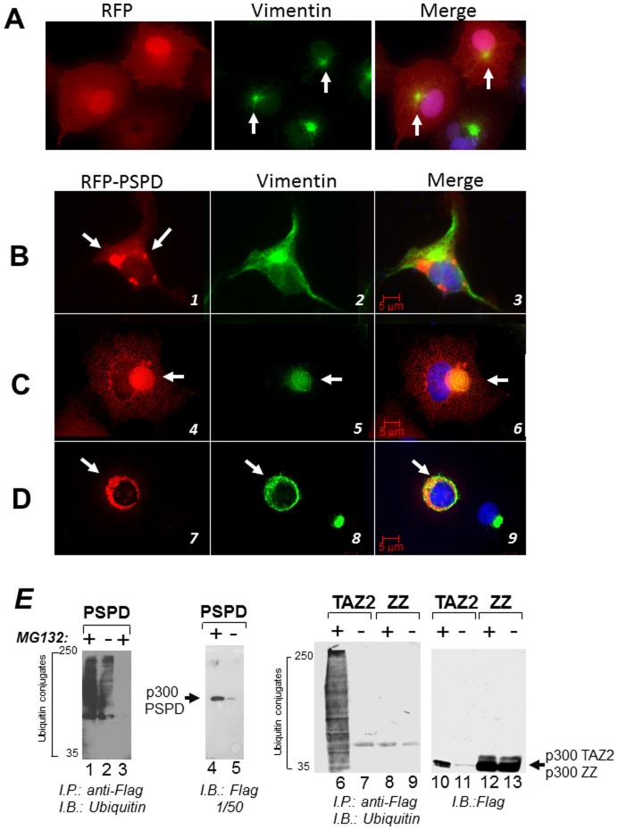 Ubiquitin Antibody (13-1600)