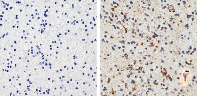 Tau Antibody (13-6400)