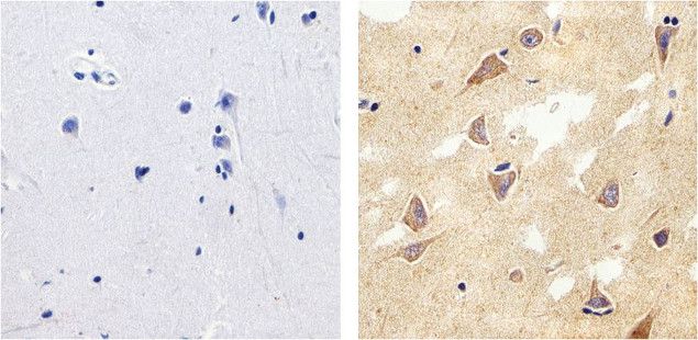 Tau Antibody (13-6400)