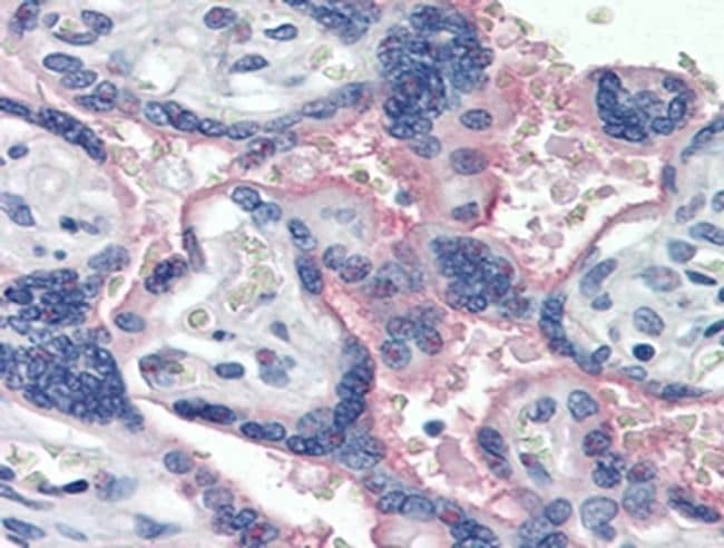 CD47 Antibody (14-0479-82)