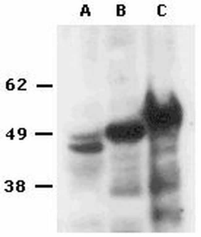 FOXP3 Antibody (14-7979-82)