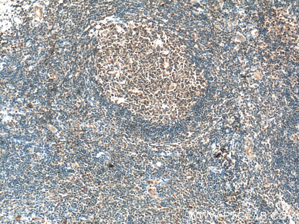 CD200 Antibody (14057-1-AP)