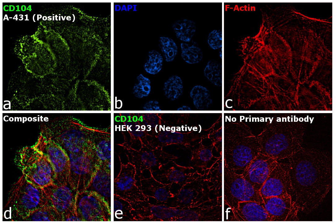 CD104 (Integrin beta 4) Antibody (14-1049-82)