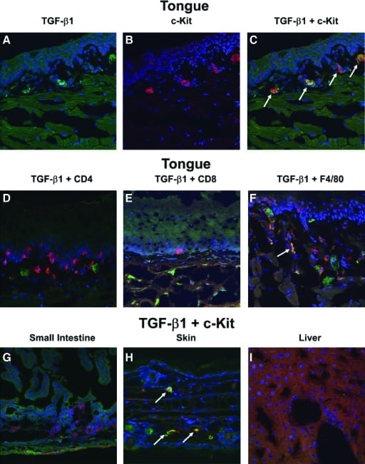 CD117 (c-Kit) Antibody (14-1172-82)