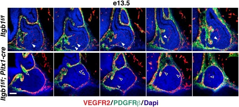 CD140b (PDGFRB) Antibody (14-1402-82)