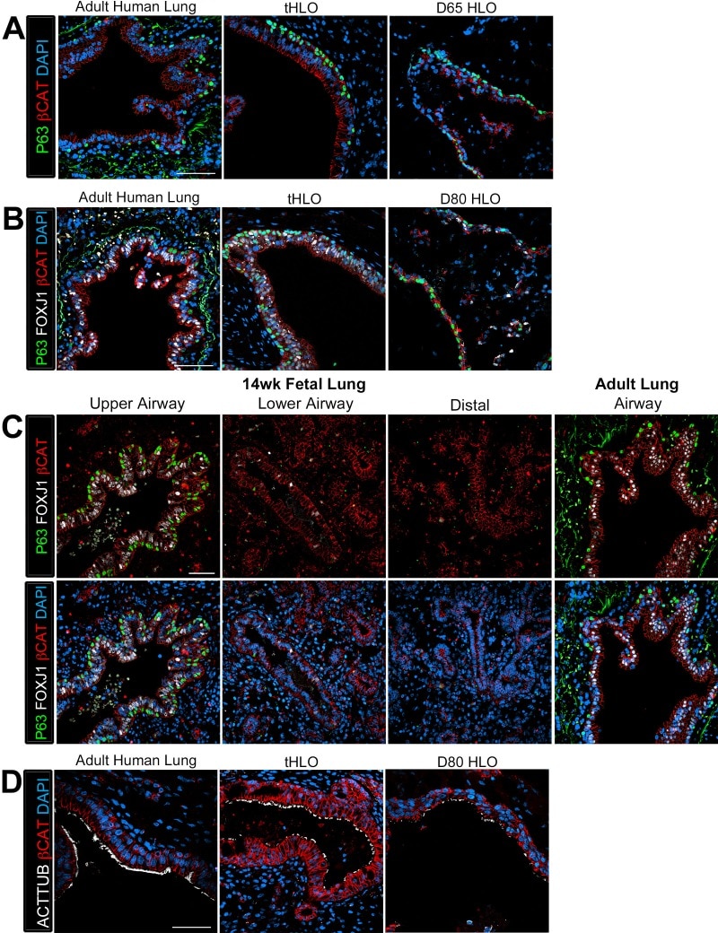 FOXJ1 Antibody (14-9965-82)