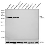 Anti-ChAT Antibodies | Invitrogen