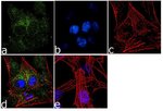Anti-slc7a11 Antibodies | Invitrogen