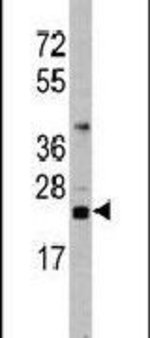 Anti-CD3 zeta (CD247) Antibodies | Invitrogen