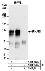 Anti-IFNAR1 Antibodies | Invitrogen