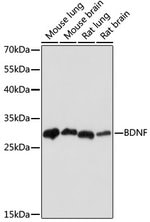 Anti-BDNF Antibodies | Invitrogen