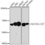 Anti-slc7a11 Antibodies | Invitrogen