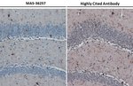 Anti-IBA1 Antibodies | Invitrogen