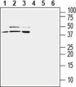Anti-TREM2 Antibodies | Invitrogen