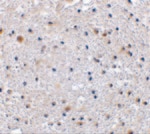 Anti-PD-1 (CD279) Antibodies | Invitrogen