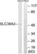 Anti-slc38a2 Antibodies | Invitrogen