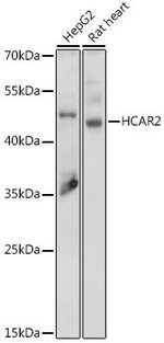 Anti-HCAR2 Antibodies | Invitrogen
