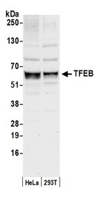 Anti-TFEB Antibodies | Invitrogen