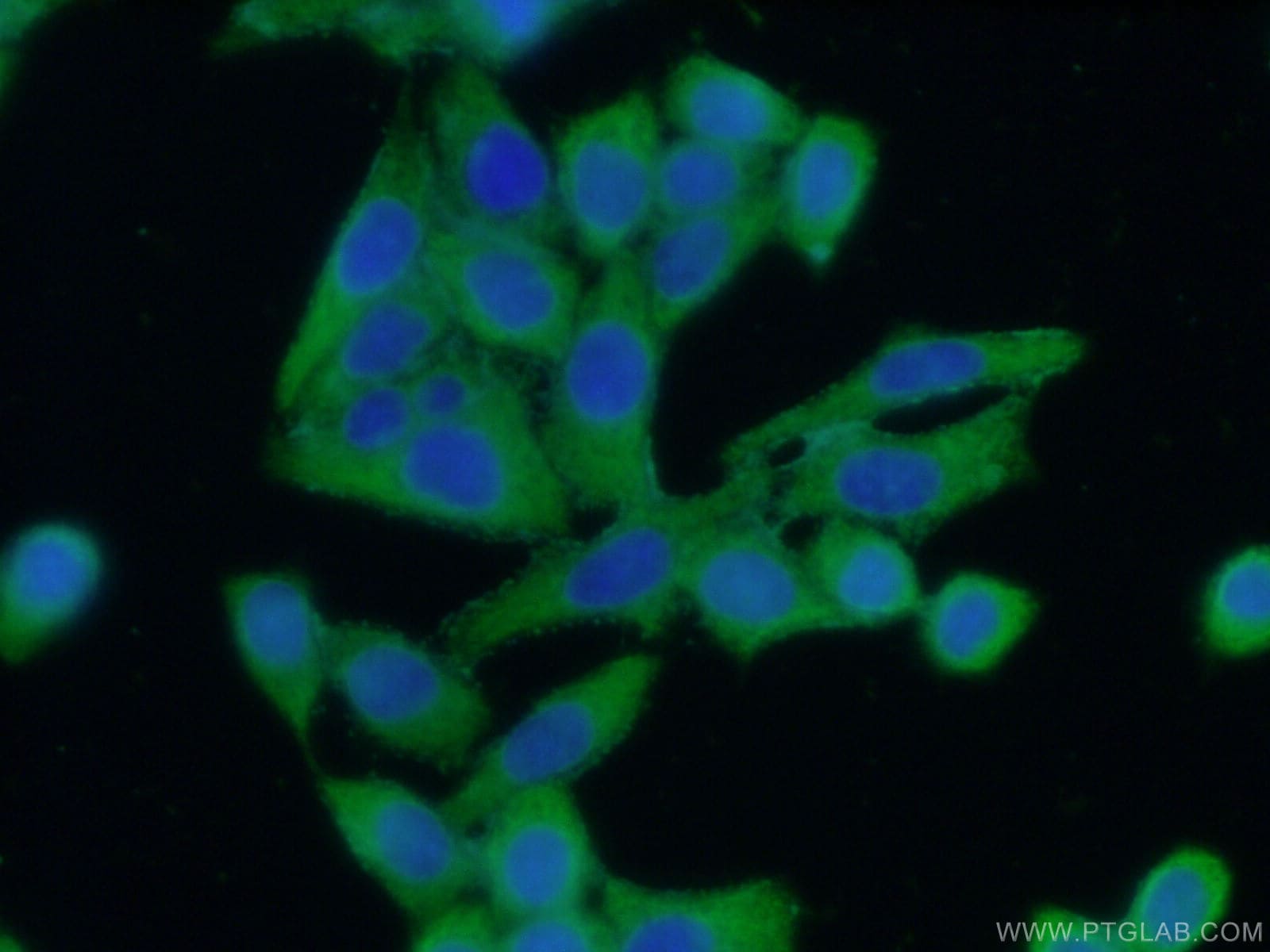 ASS1 Antibody (16210-1-AP)