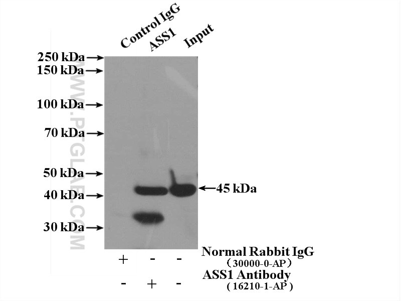 ASS1 Antibody (16210-1-AP)