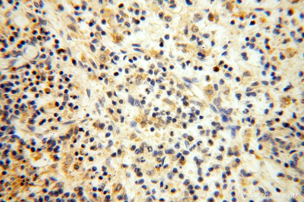 IL15RA Antibody (16744-1-AP)