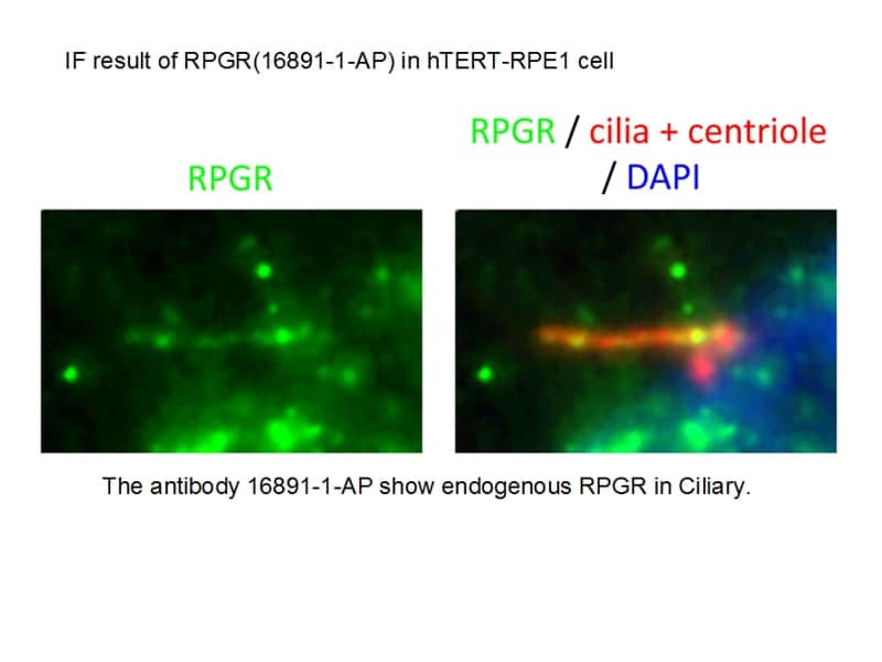 RPGR Antibody (16891-1-AP)