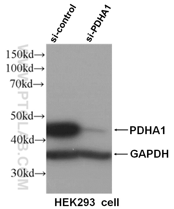 PDH E1 alpha Antibody (18068-1-AP)