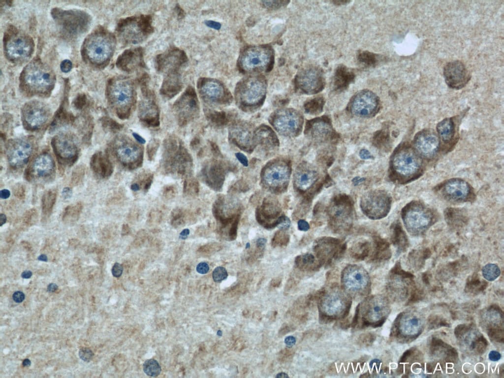 PSD95/DLG4 Antibody (20665-1-AP)