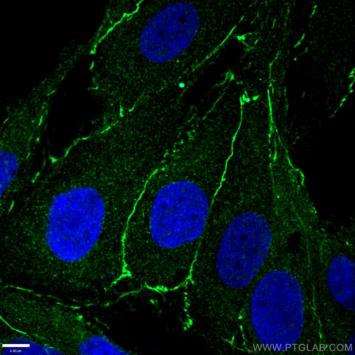 ZO-1 Antibody (21773-1-AP)