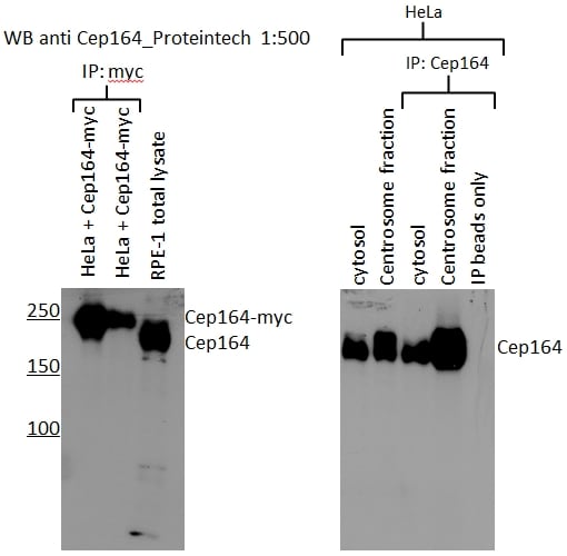CEP164 Antibody (22227-1-AP)