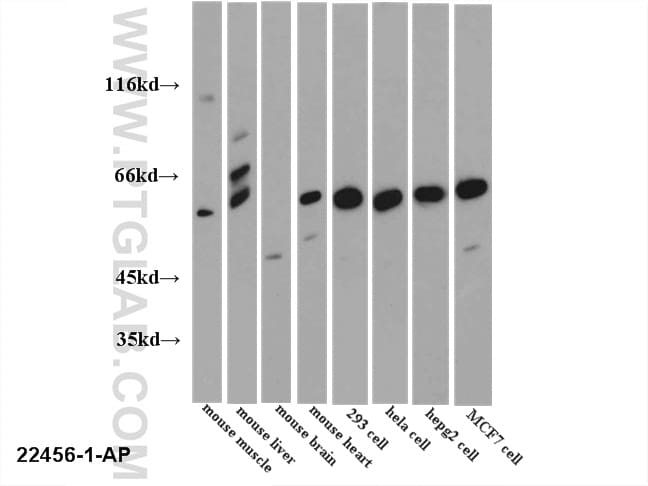 PKLR Antibody (22456-1-AP)