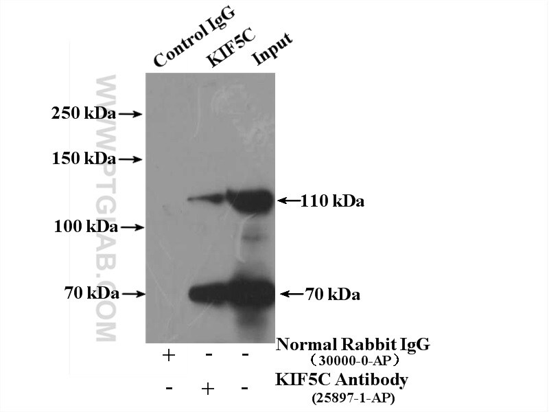 KIF5C Antibody (25897-1-AP)