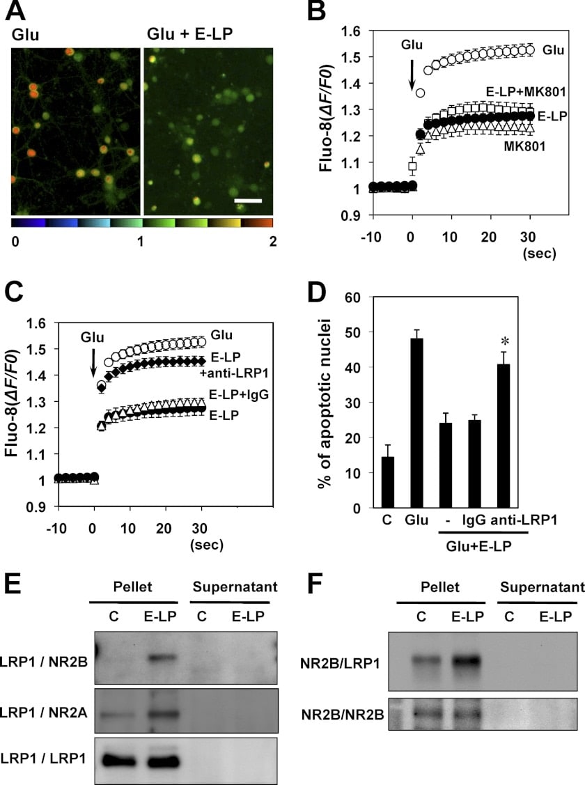 NMDAR2B Antibody (32-0700)