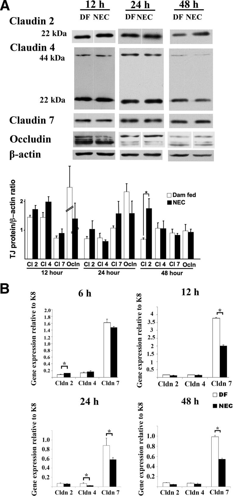 Occludin Antibody (42-2400)