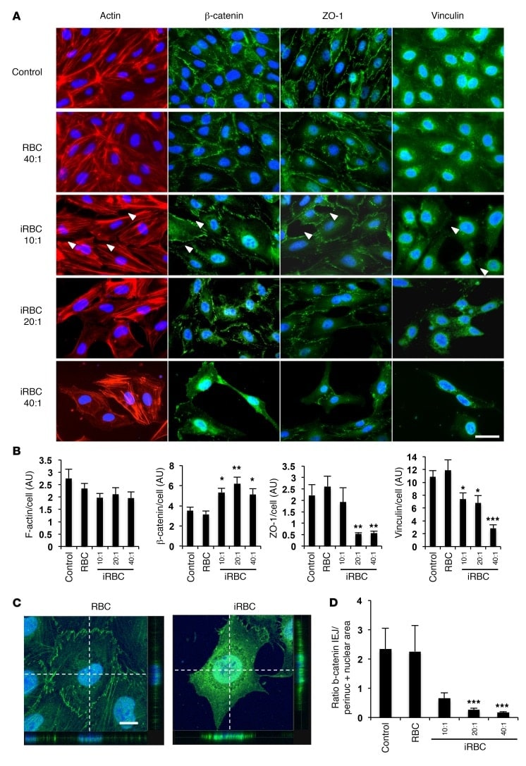 Vinculin Antibody (700062)