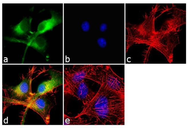 beta Amyloid Antibody (36-6900)