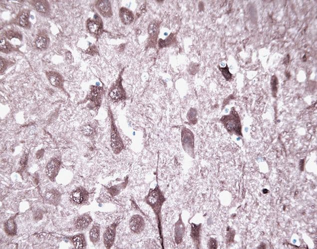 PGP9.5 Antibody (38-1000)