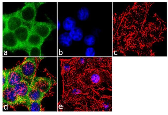 PKC zeta Antibody (38-1400)
