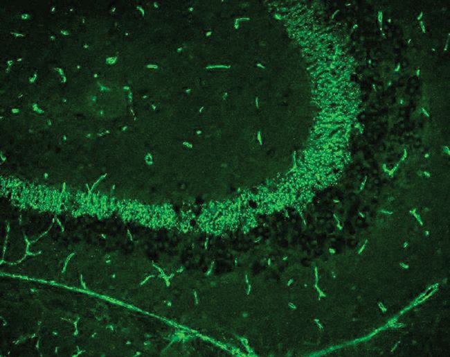 ZO-1 Antibody (40-2200)
