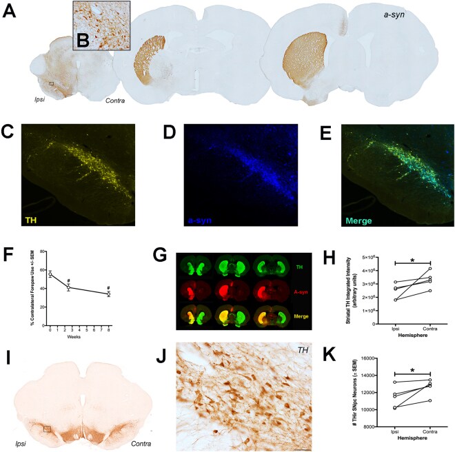 alpha Synuclein Antibody (AHB0261)