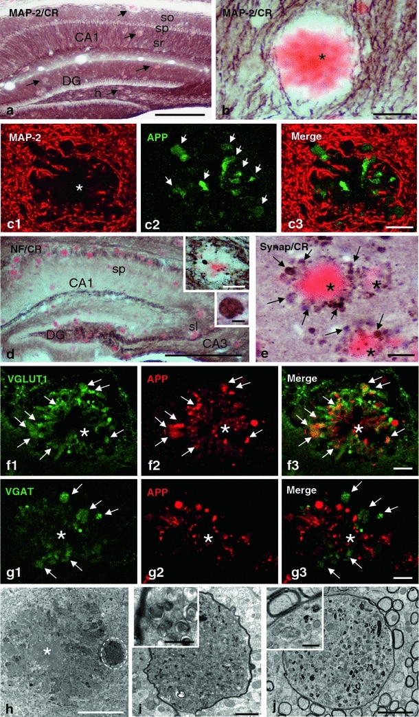 beta Amyloid (1-42) Antibody (44-344)