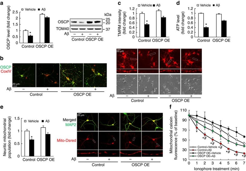 ATP5A1 Antibody (459240)