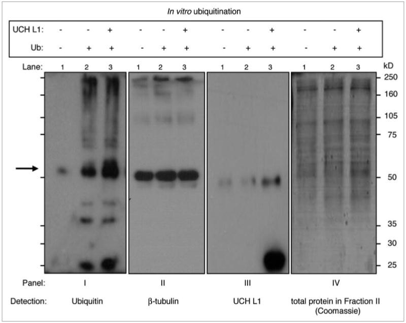 PGP9.5 Antibody (480012)