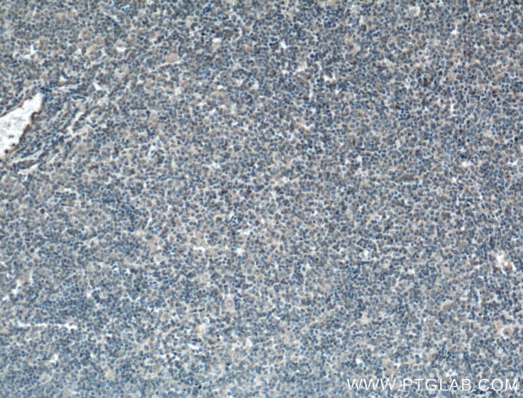 BAX Antibody (50599-2-IG)