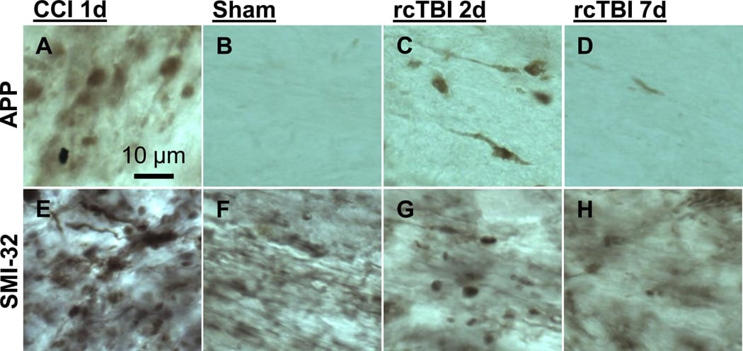 beta Amyloid Antibody (51-2700)