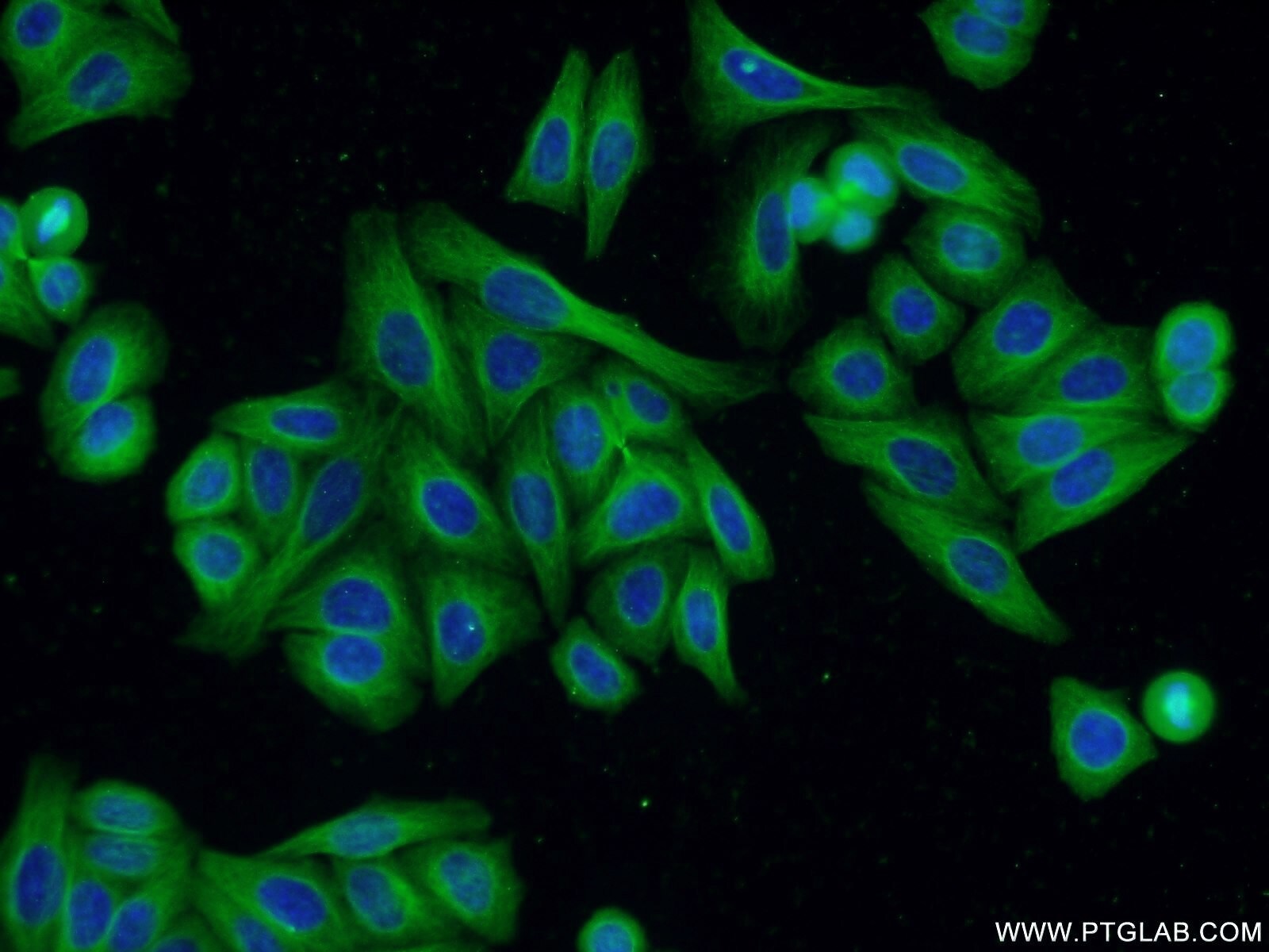 beta Tubulin Antibody (66240-1-IG)